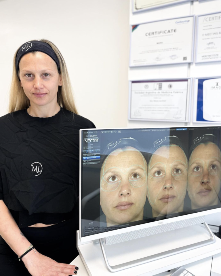 Vectra H2 - Análisis Facial con Imágenes 3D