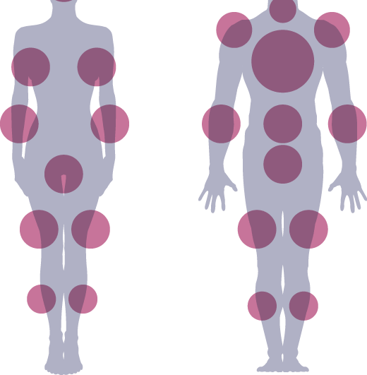 Depilación Definitiva Candela Buenos Aires, Palermo - Dra. Maria Lucchesi